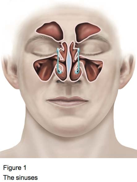 Sinus Surgery New Victoria Hospital